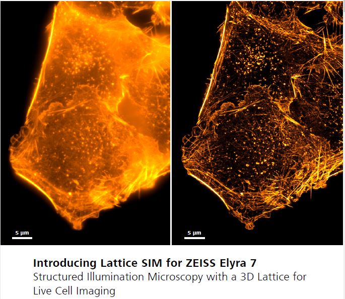 Super-resolution fluorescence microscopy | University of Gothenburg