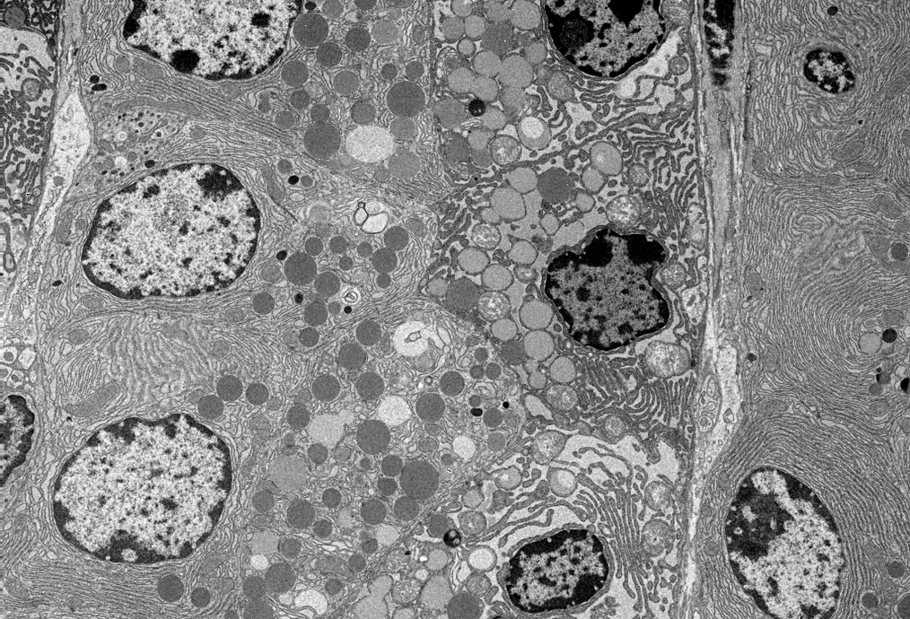 Transmission Electron Microscope Images Of Cells