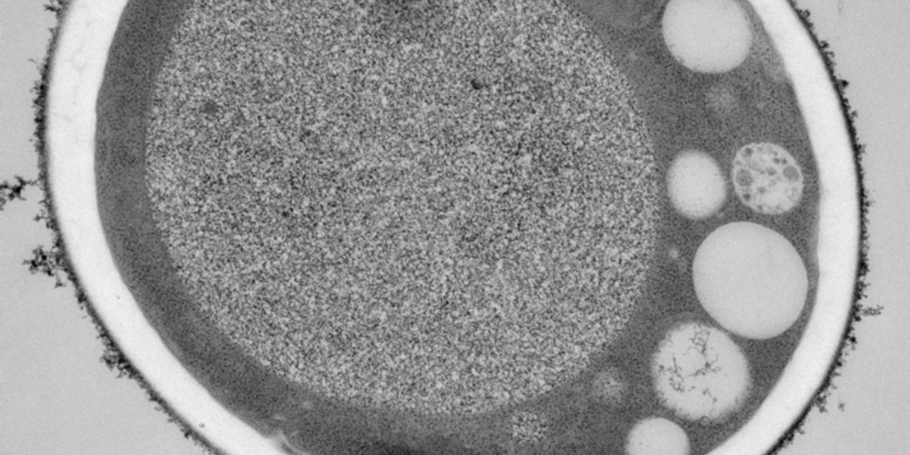 High pressure freezing and freeze substitution | University of Gothenburg