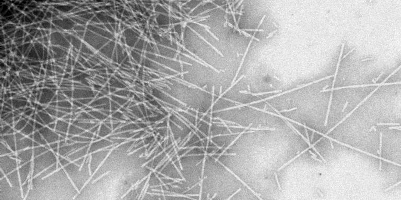 Negative staining | University of Gothenburg