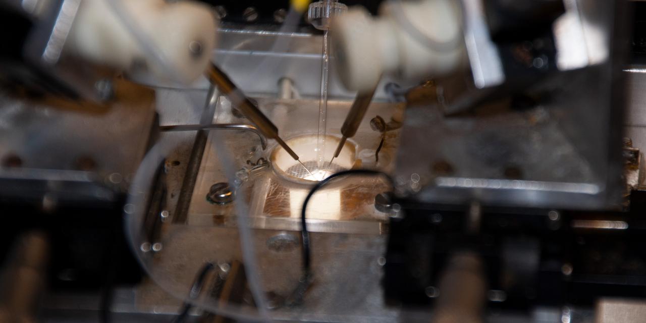 Integrative neuroscience | University of Gothenburg