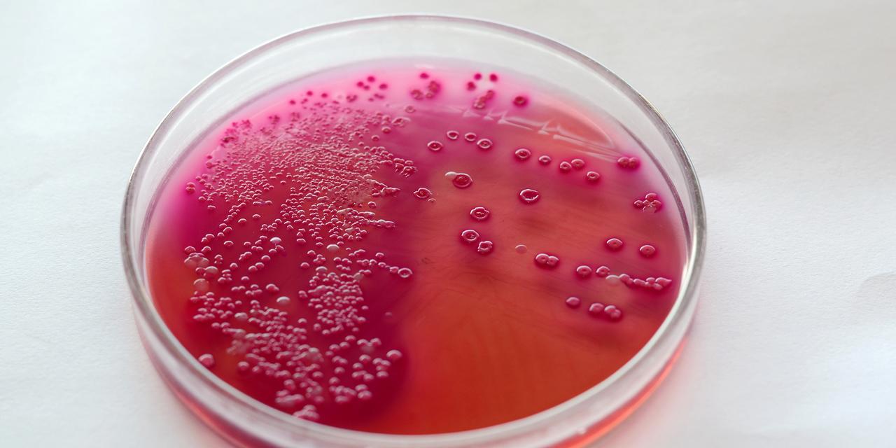 Dissemination and virulence of bacterial gastrointestinal infections ...