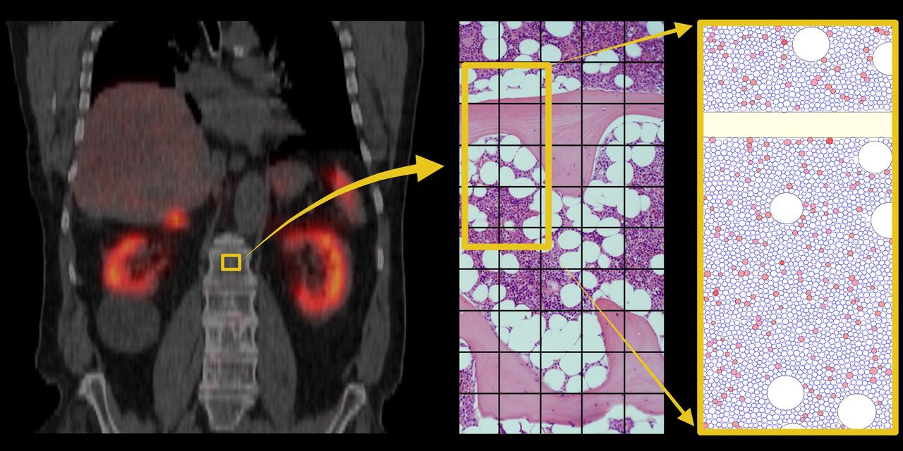 Jens Hemmingsson - Small-scale dosimetry methods for normal tissues ...