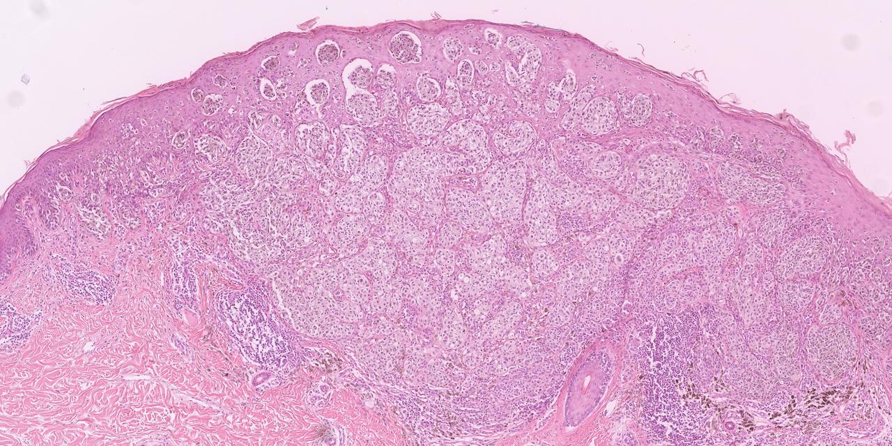 Novel imaging technologies and artificial intelligence in digital ...