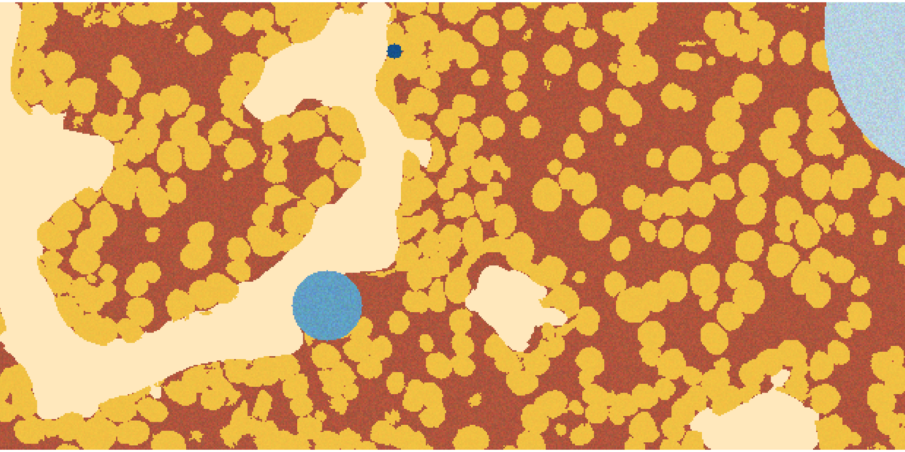 Linn Hagmarker: Image-based method for bone marrow dosimetry ...