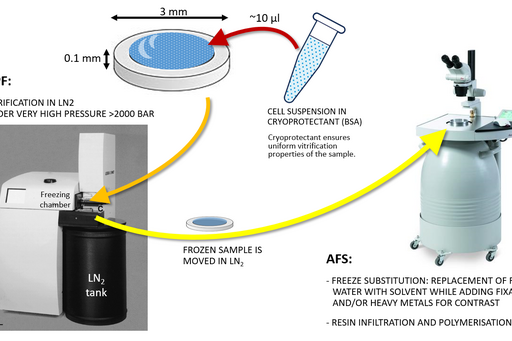 TEM sample preparation techniques | Core Facilities, University of Gothenburg