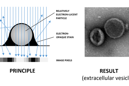TEM sample preparation techniques | Core Facilities, University of Gothenburg